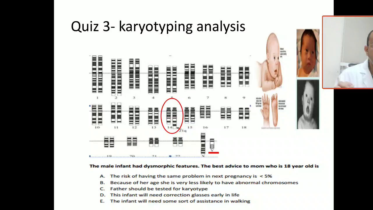 Case 5 Down syndrome ,how to interpreting karyotyping results, - YouTube