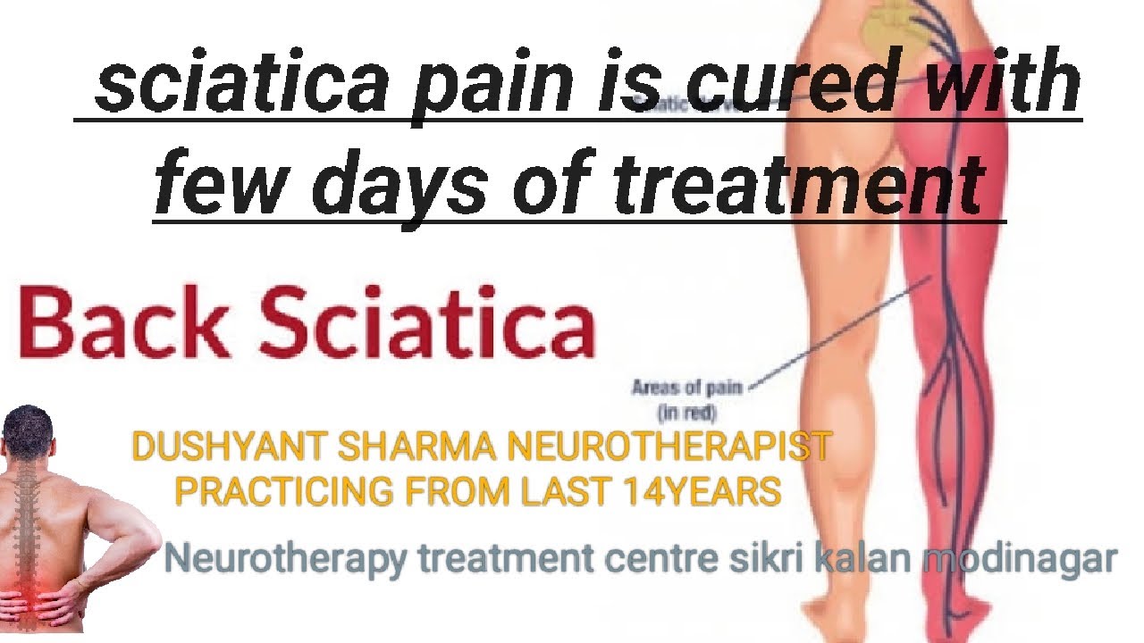 #Sciatica pain is cured with few days of treatment# - YouTube