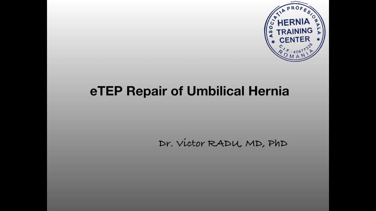 eTEP Umbilical Hernia Repair - YouTube