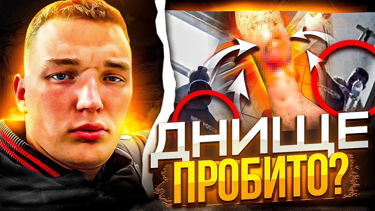 ЭДВАРД БИЛ ВСЕХ РАЗВЁЛ? ВСЯ ПРАВДА ПРО НОГУ / ФРЕЙМ ТЕЙМЕР БОМБИТ ...