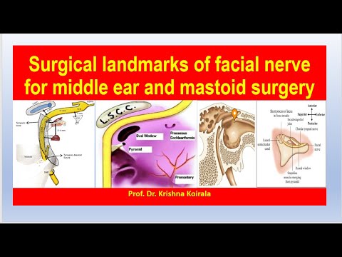Surgical landmarks for facial nerve during middle ear and mastoid ...