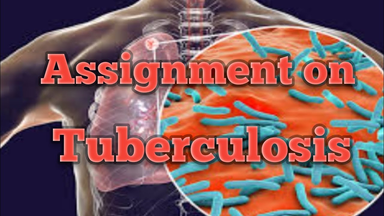Assignment on------- Tuberculosis - YouTube