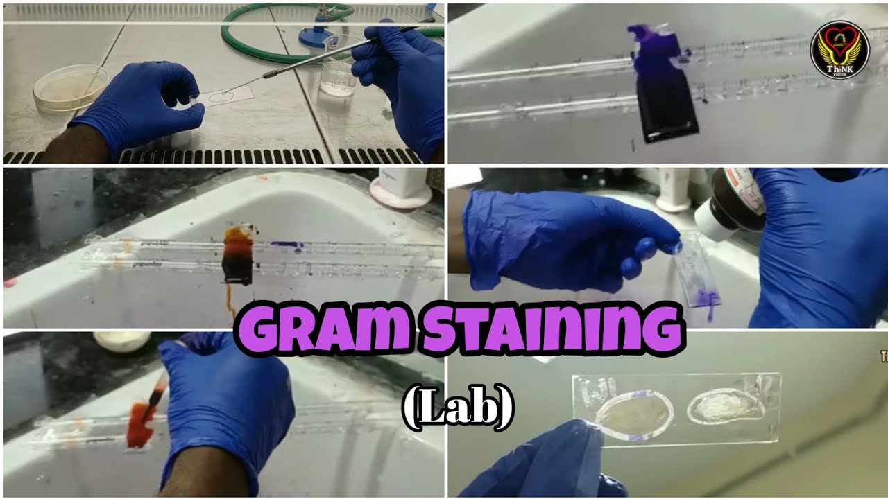 Gram Staining | Demo | Smear Preparation | Microbiology Lab | Tamil ...