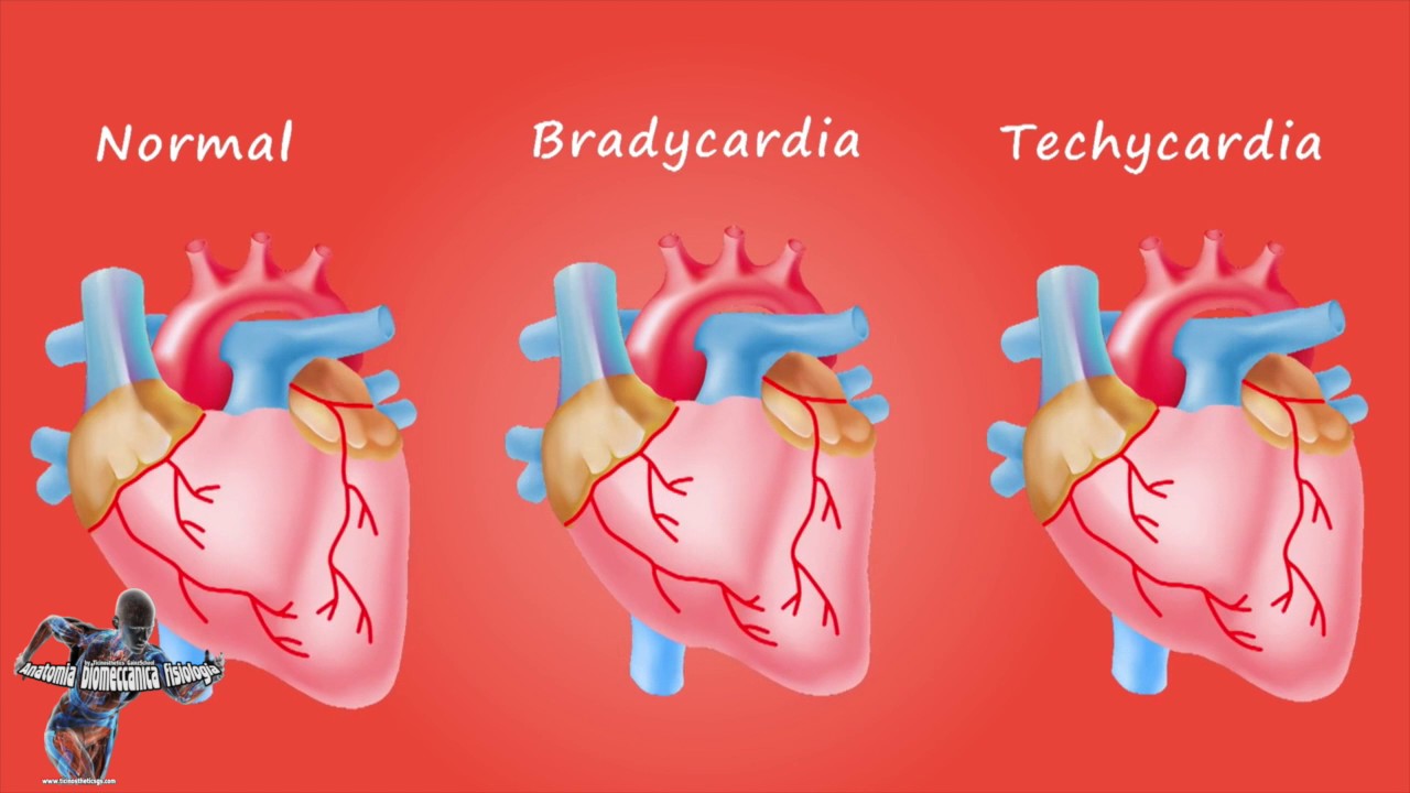 Bradicardia e tachicardia (cuore) - YouTube