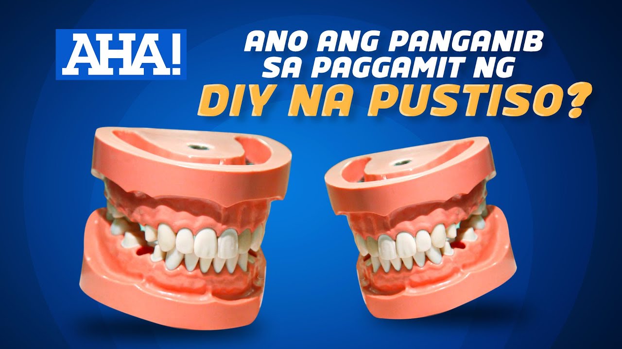 Ano ang panganib sa paggamit ng DIY na pustiso? | AHA! - YouTube