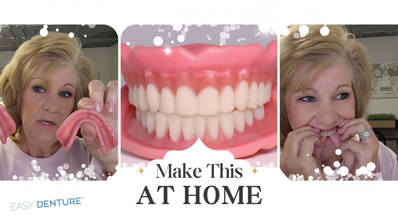 Easy Dentures from HOME / Affordable Dentures you MOLD at Home - YouTube