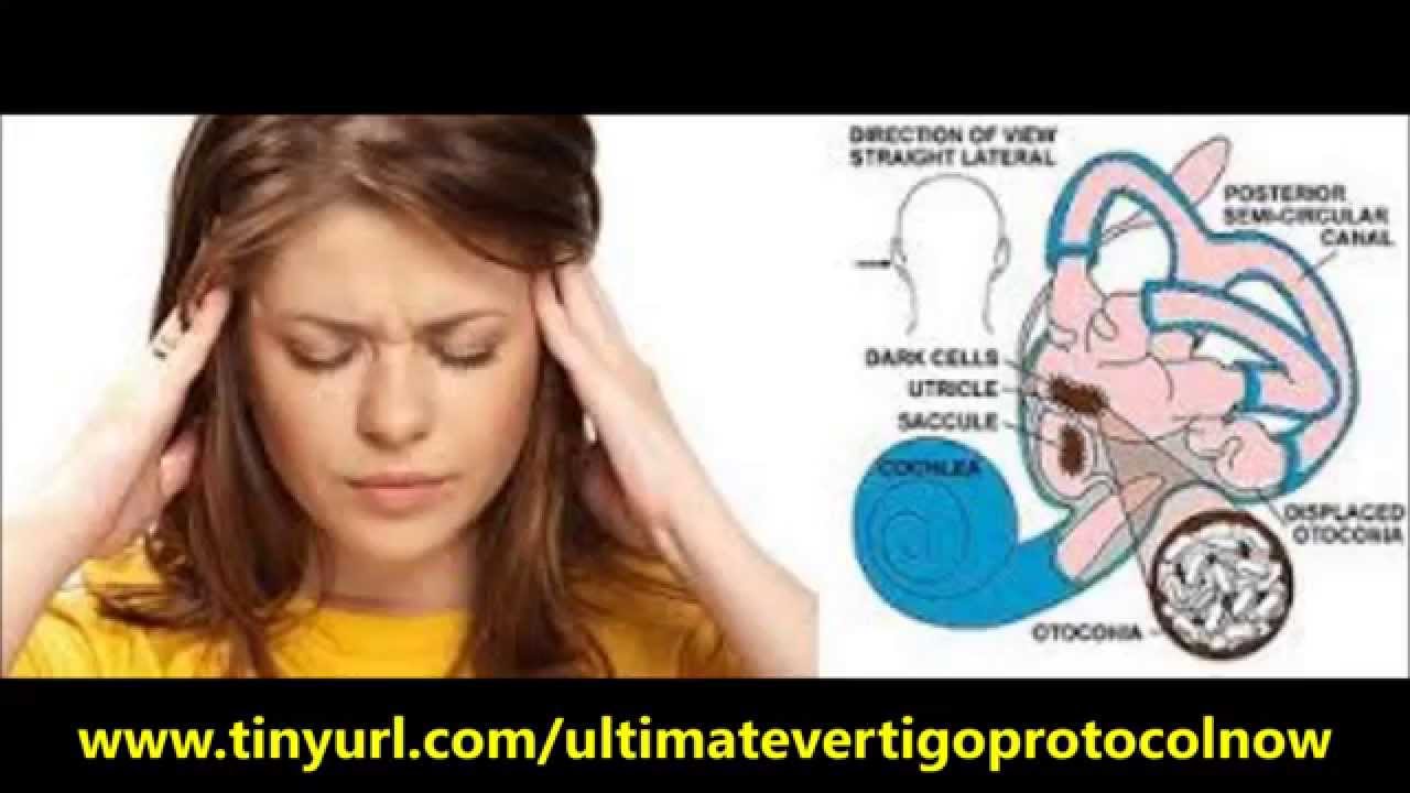 The Ultimate Vertigo Protocol Robert Mueck | Amazing The Ultimate ...