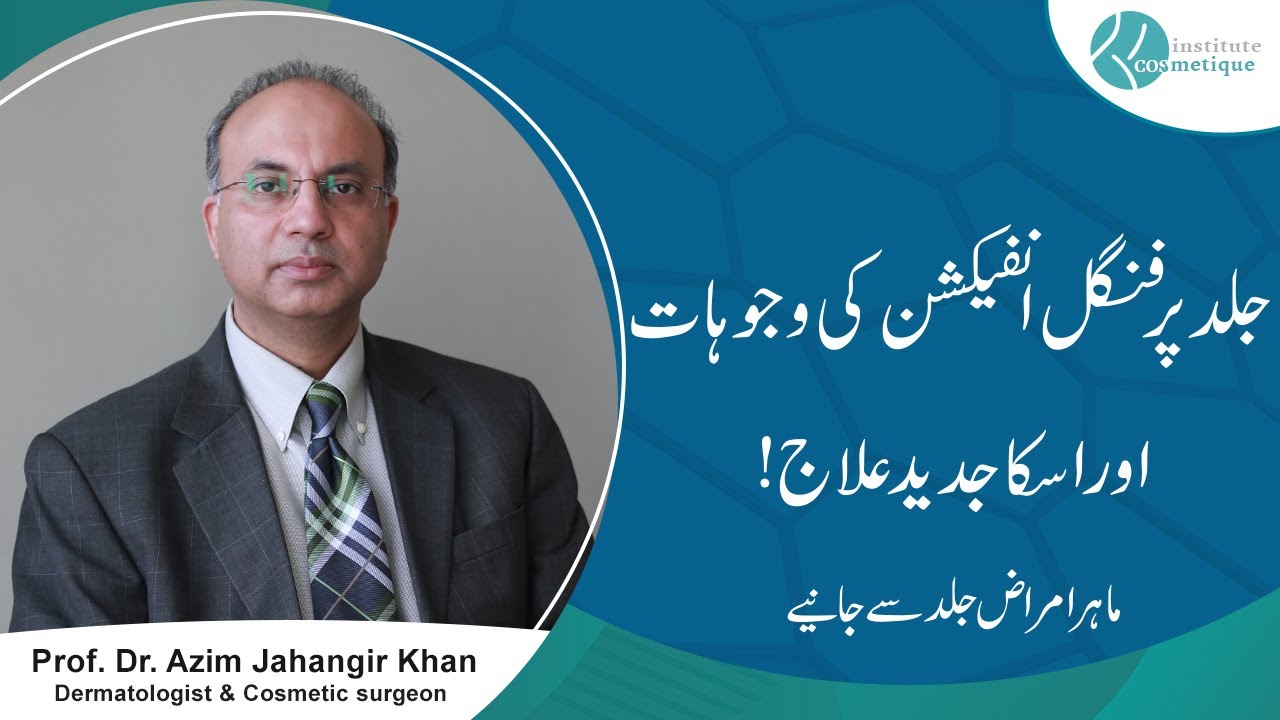 Fungal Infection Treatment - Types Of Fungal Infection - Fungus Ka Ilaj ...