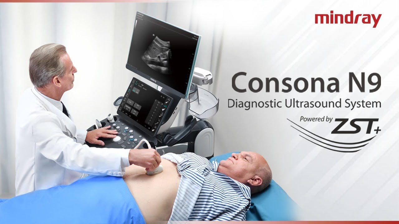 Consona N Series: Elevate Your Diagnostic Ultrasound Experience - YouTube