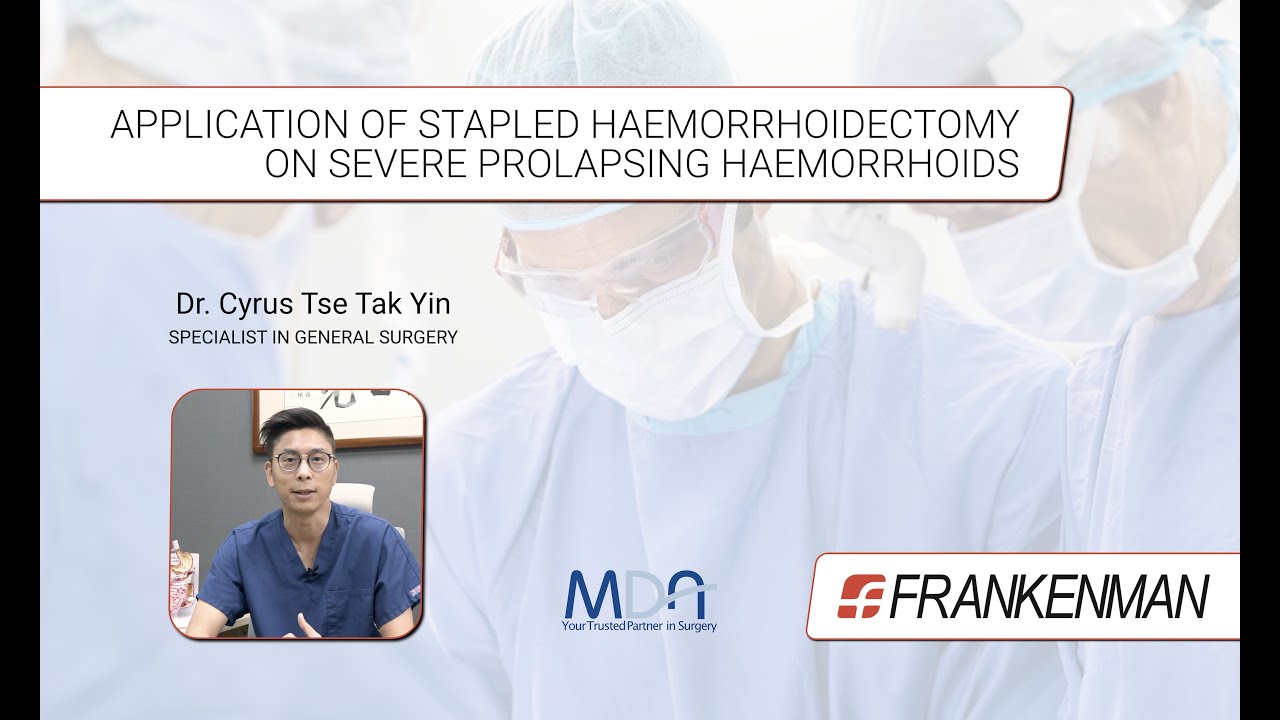 Tutorial on Stapled Haemorrhoidectomy on Severe Prolapsing Hemorrhoids ...