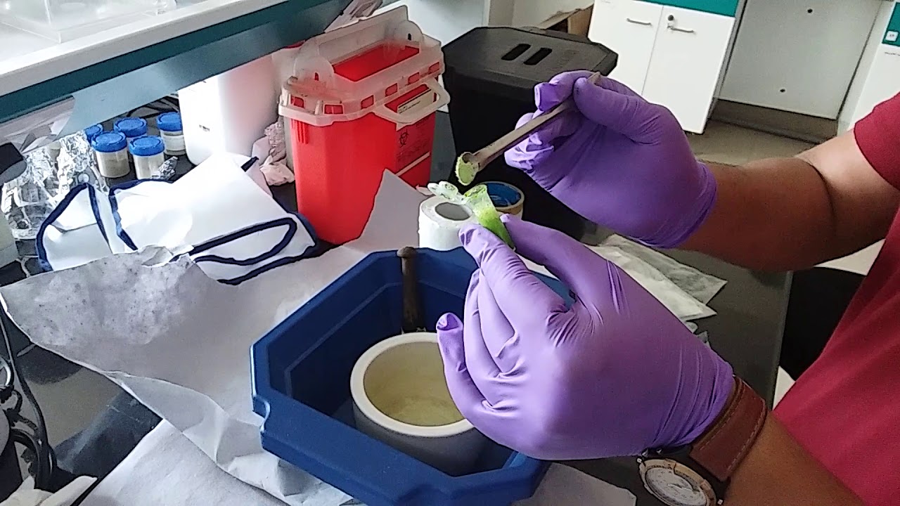 Squashing of leaf sample with liquid nitrogen for DNA isolation - YouTube