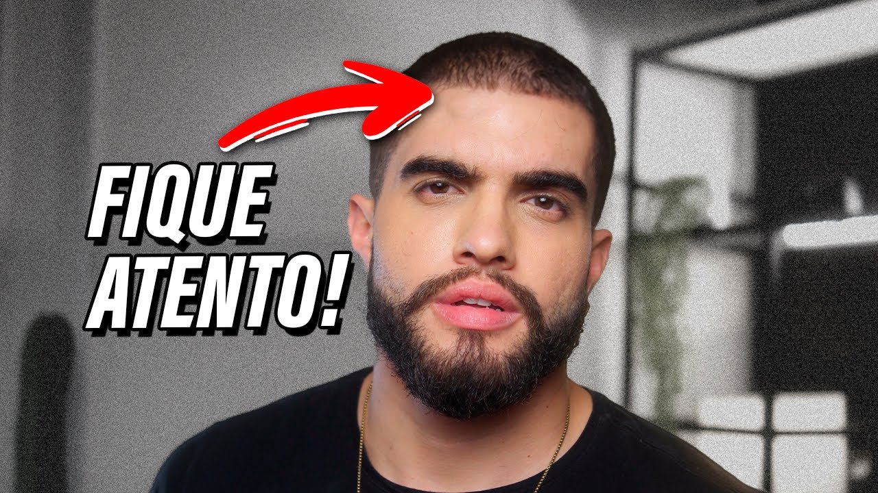 Sinais que Você vai FICAR CALVO - YouTube