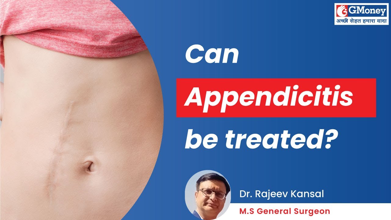 Is Surgery important for Appendicitis Treatment? GMoney Health Show ...