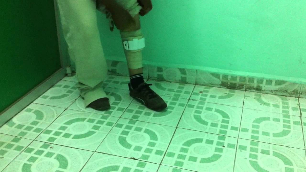 férula dinámica para pie pendulo - YouTube