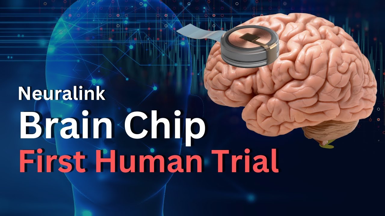 First Neuralink Brain chip Implanted: What's Next... - YouTube