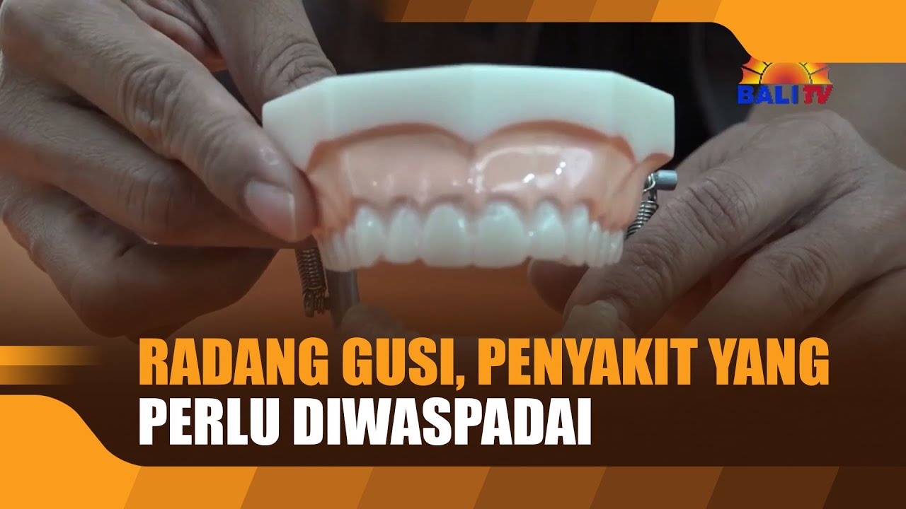 RADANG GUSI, PENYAKIT YANG PERLU DIWASPADAI - YouTube
