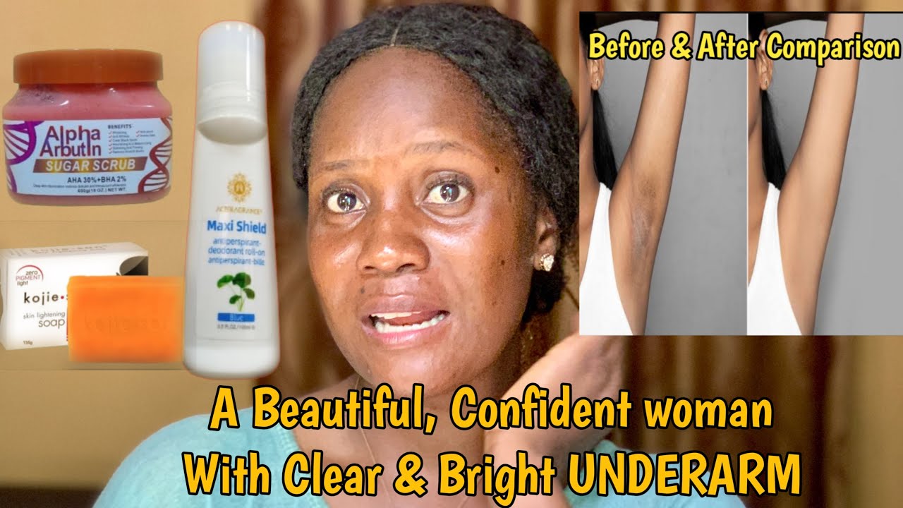 Natural Remedies for underarm discoloration ||Effective Products for ...