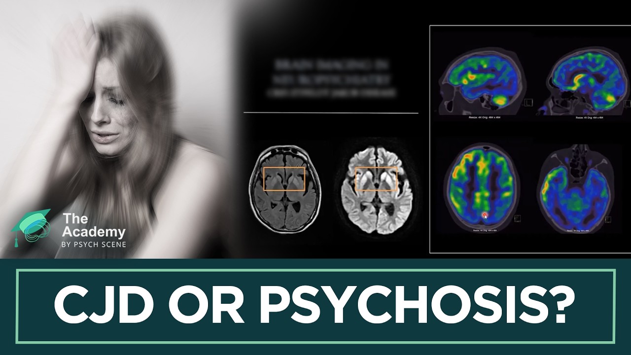 Neuroimaging and EEG in the Assessment of Atypical Psychosis | Dr Jesús ...