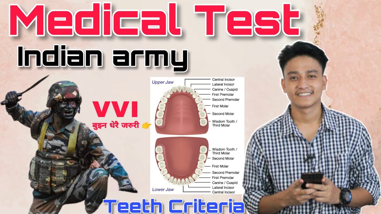Indian Army Medical test // Teeth criteria// Detail. - YouTube