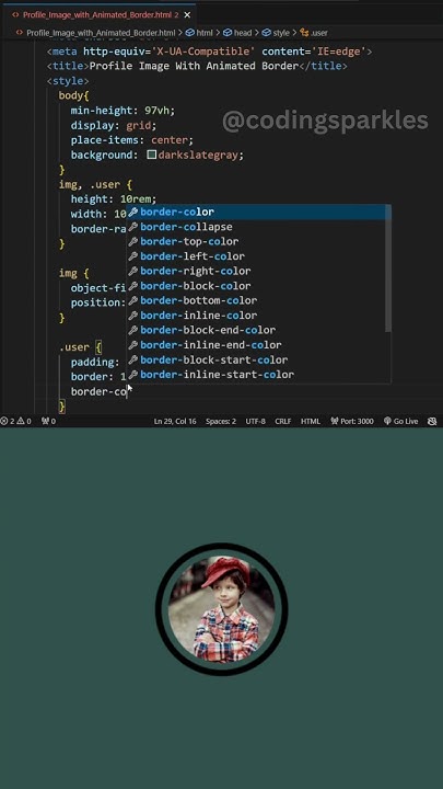 Profile Image With Animated Border Html Css Css Htmlcss Cssanimation Youtube