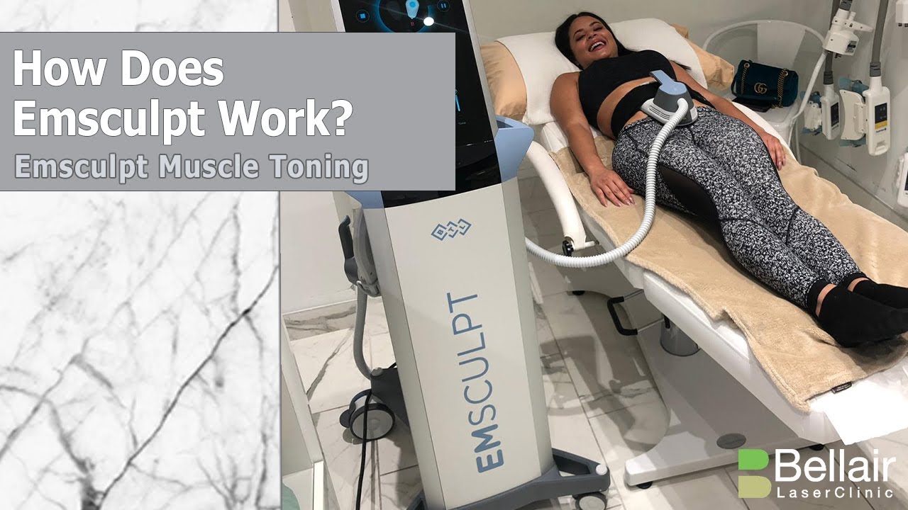 Emsculpt explainer video plus treatment demo - YouTube