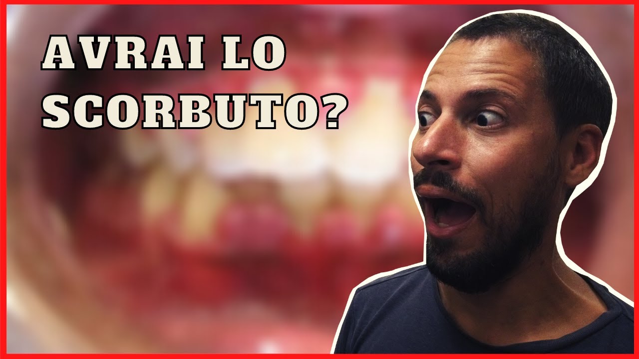 La dieta carnivora ti farà avere lo scorbuto? - YouTube