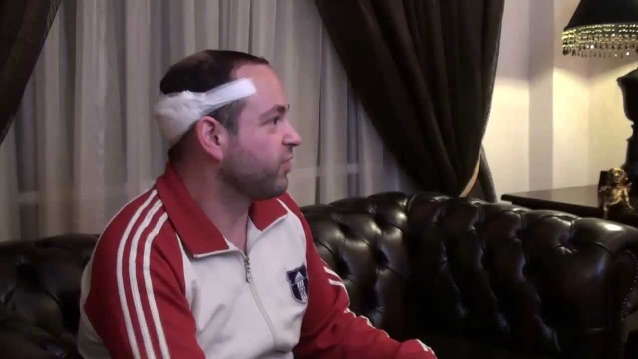 Cristo Foufas Post-treatment interview - YouTube