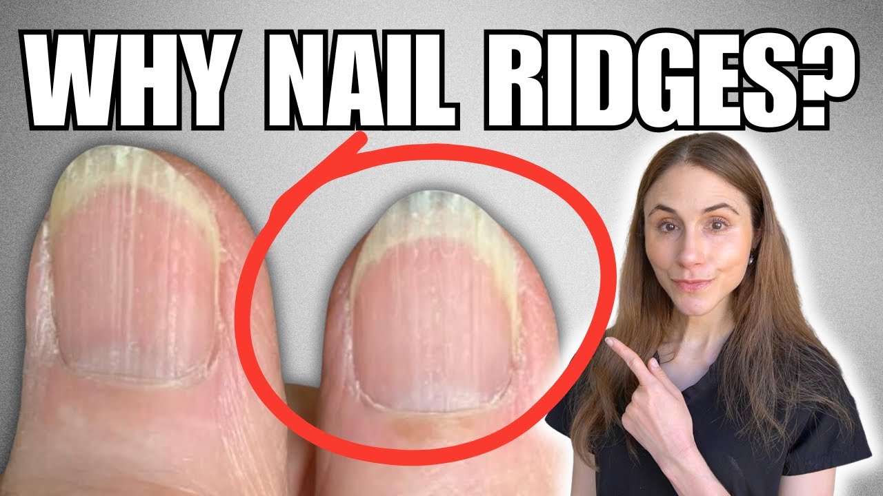 Horizontal Lines On Fingernails Horizontal Ridges In Nails FAQ & Tips