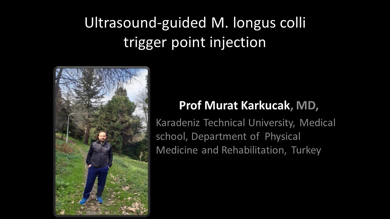 Ultrasound-guided M. longus colli trigger point injection, by Prof ...