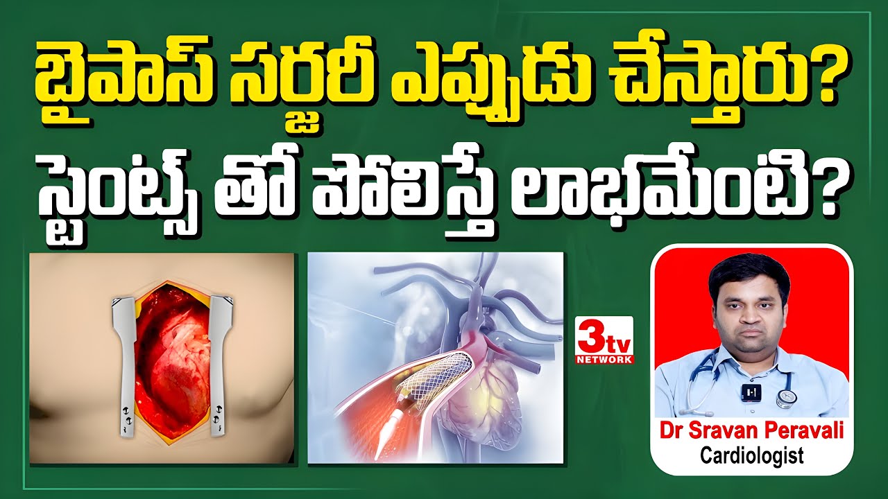 హార్ట్ బ్లాక్స్ కి స్టెంట్స్ మంచివా, బైపాస్ సర్జరీ బెటరా I Dr Sravan ...