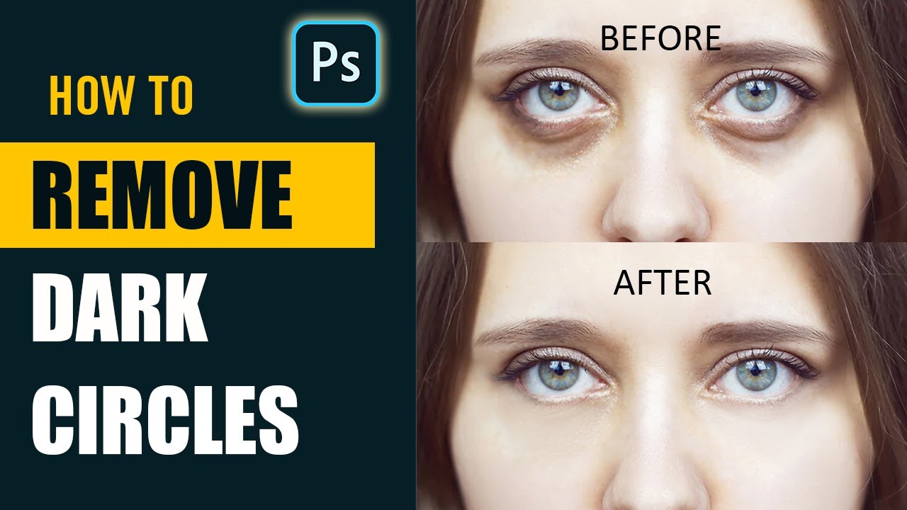 How To Remove Dark Circles In Photoshop Urdu Hindi YouTube how-to-remove-dark-circles-in-photoshop-urdu-hindi-youtube