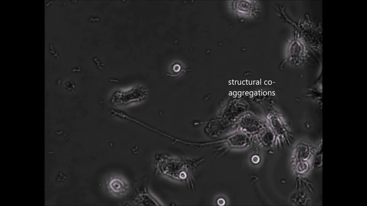 Polymicrobial synergy within oral biofilm promotes invasion of ...