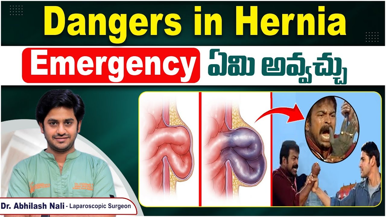 హెర్నియా ఉందో లేదో తెలియాలంటే | How to Diagnose Hernia at Home ...