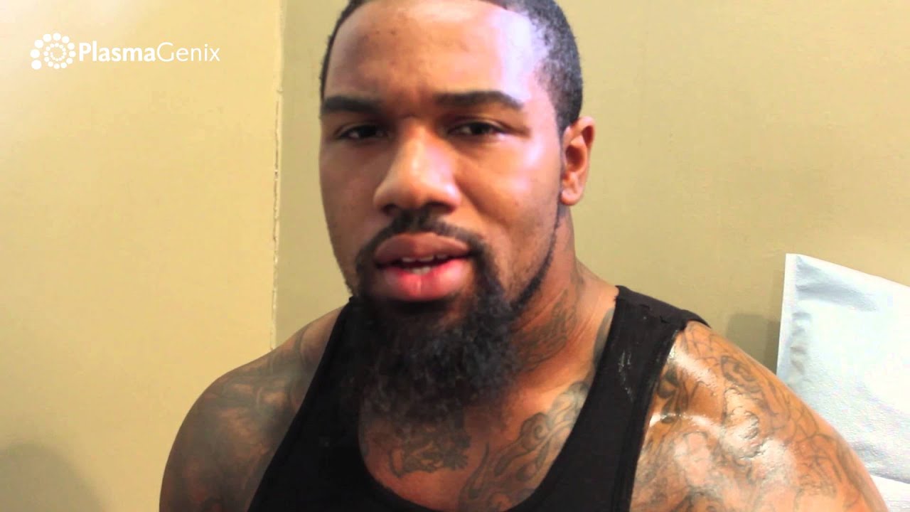 PlasmaGenix | James "The BEAST" Wilson | Treated with PlasmaPro - YouTube