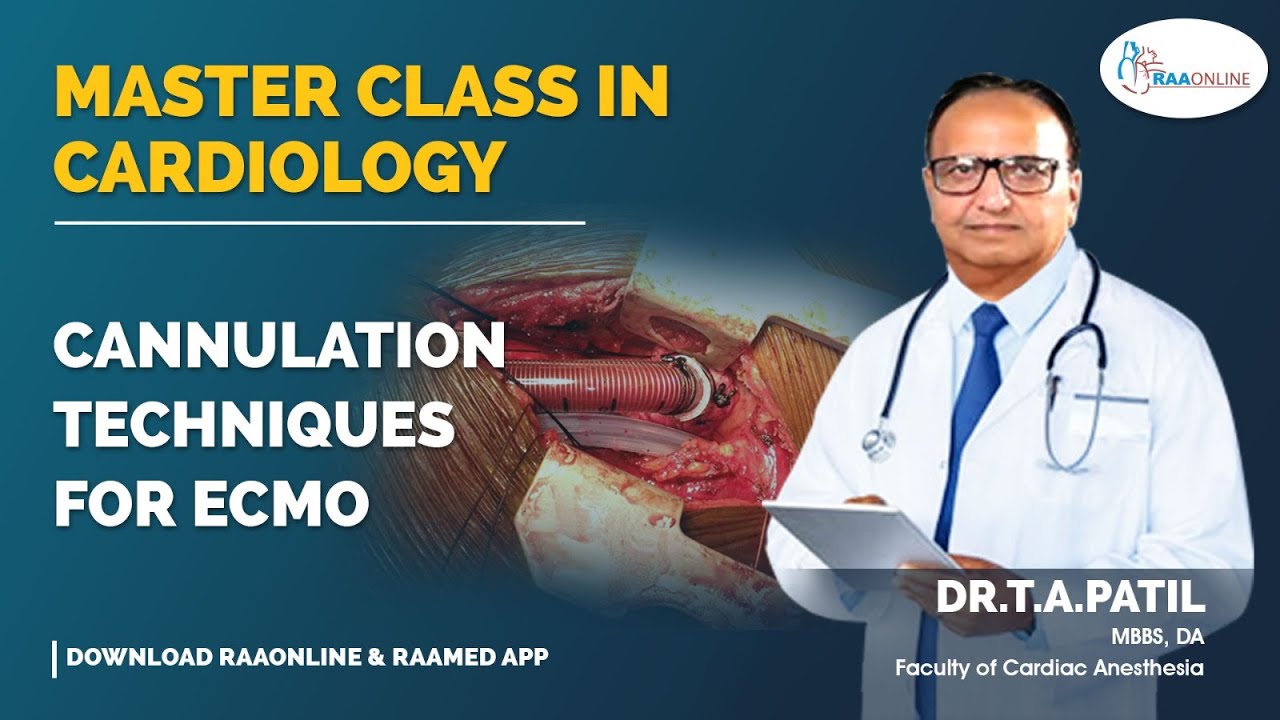 Cannulation Techniques for ECMO - Master Class in Cardiology - YouTube