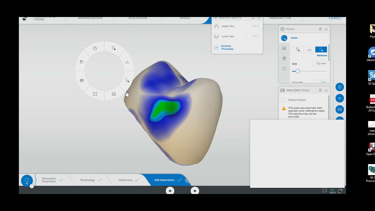 Designing Tooth #12 in CEREC SW 5.1.3 - YouTube