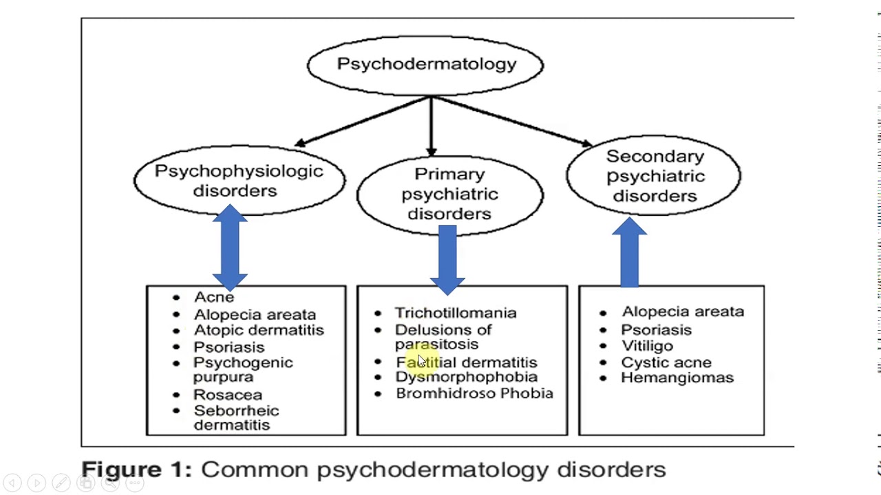 psychodermatology part-3 - YouTube