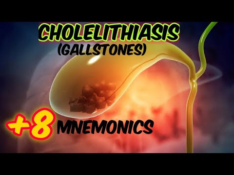 Cholelithiasis | gall stones mnemonics|medical_mnemonics786 - YouTube