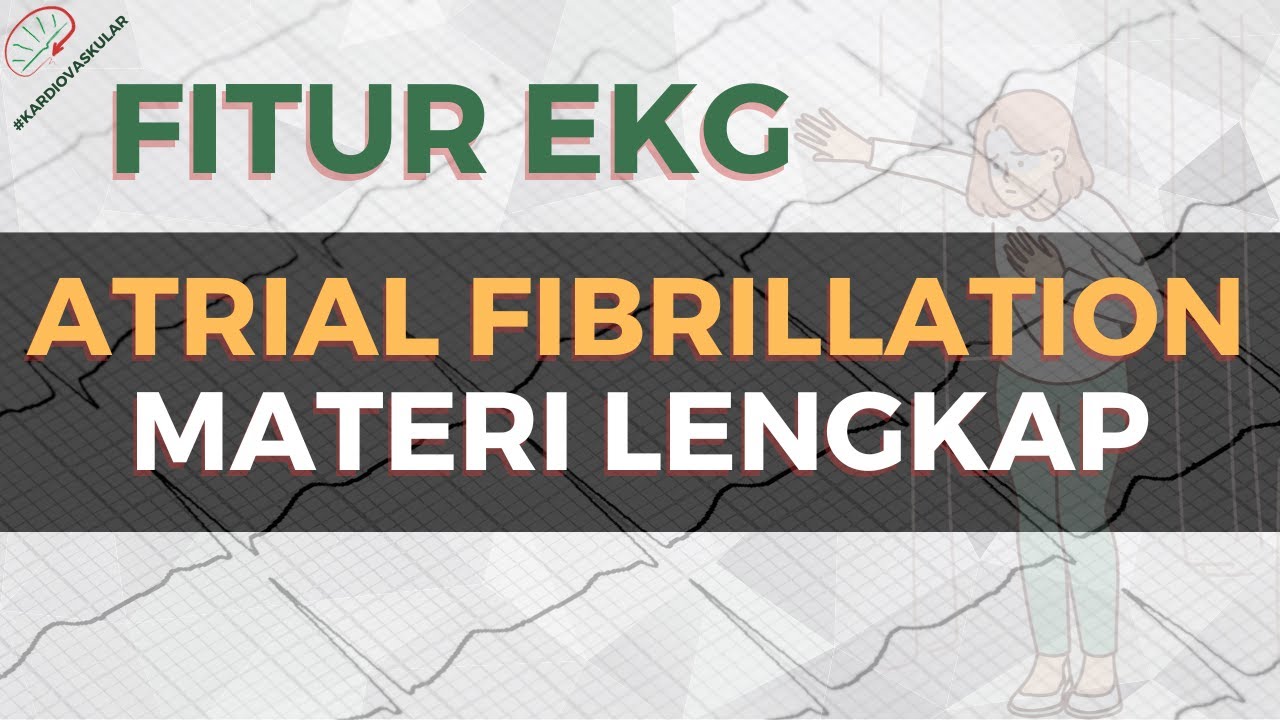 ATRIAL FIBRILLATION DAN FITUR EKG | SISTEM KARDIOVASKULAR - YouTube