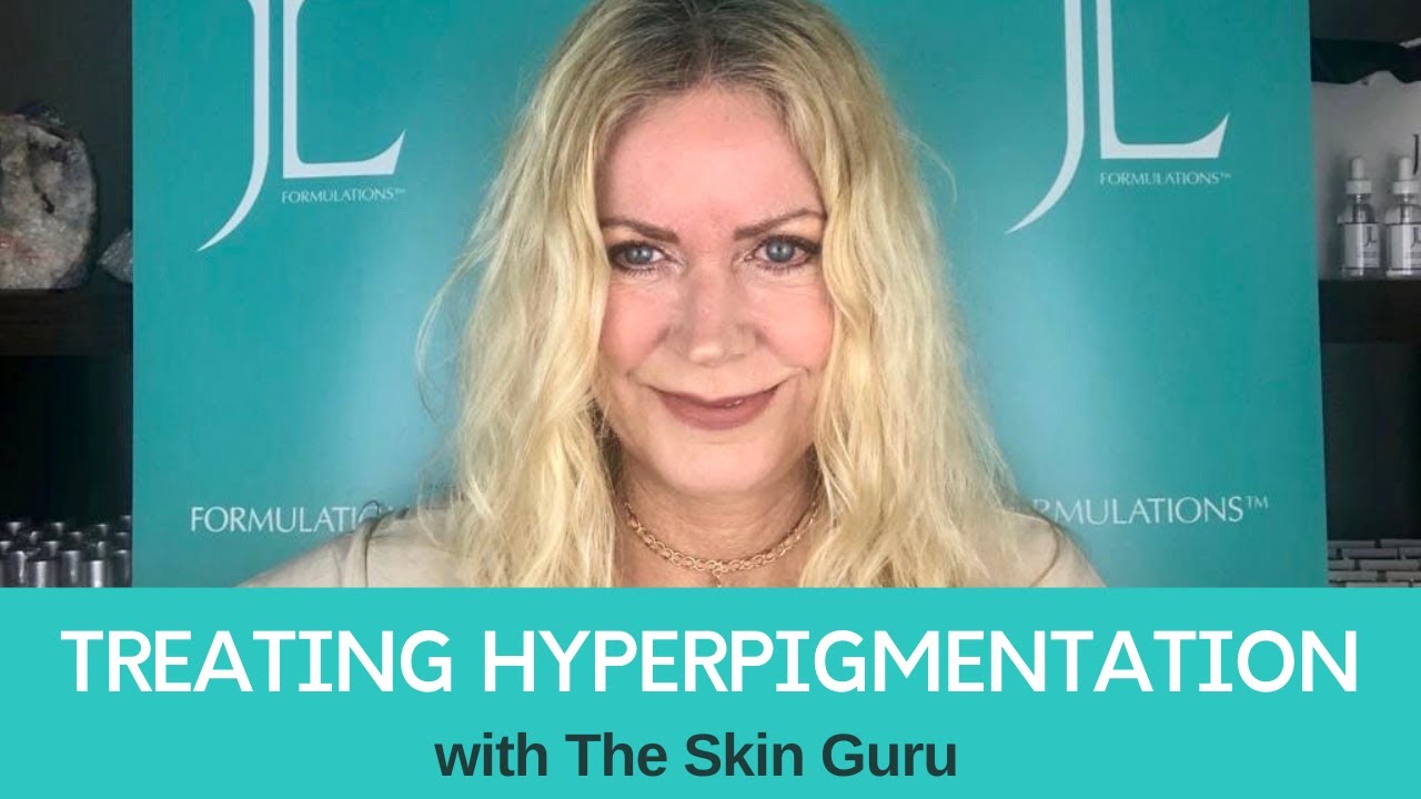 HYPERPIGMENTATION | MELASMA | HOW TO FADE DARK SPOTS, PREGNANCY MASK ...