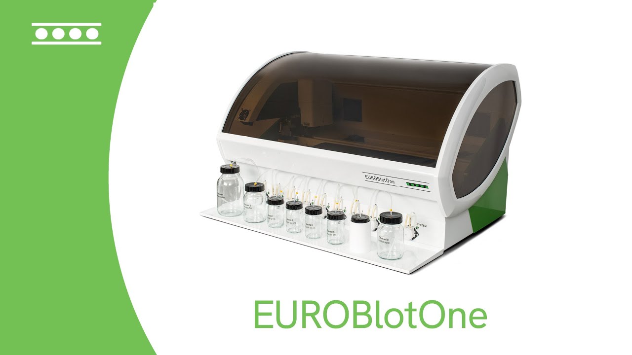 EUROBlotOne - Fully automated processing of immunoblots - YouTube