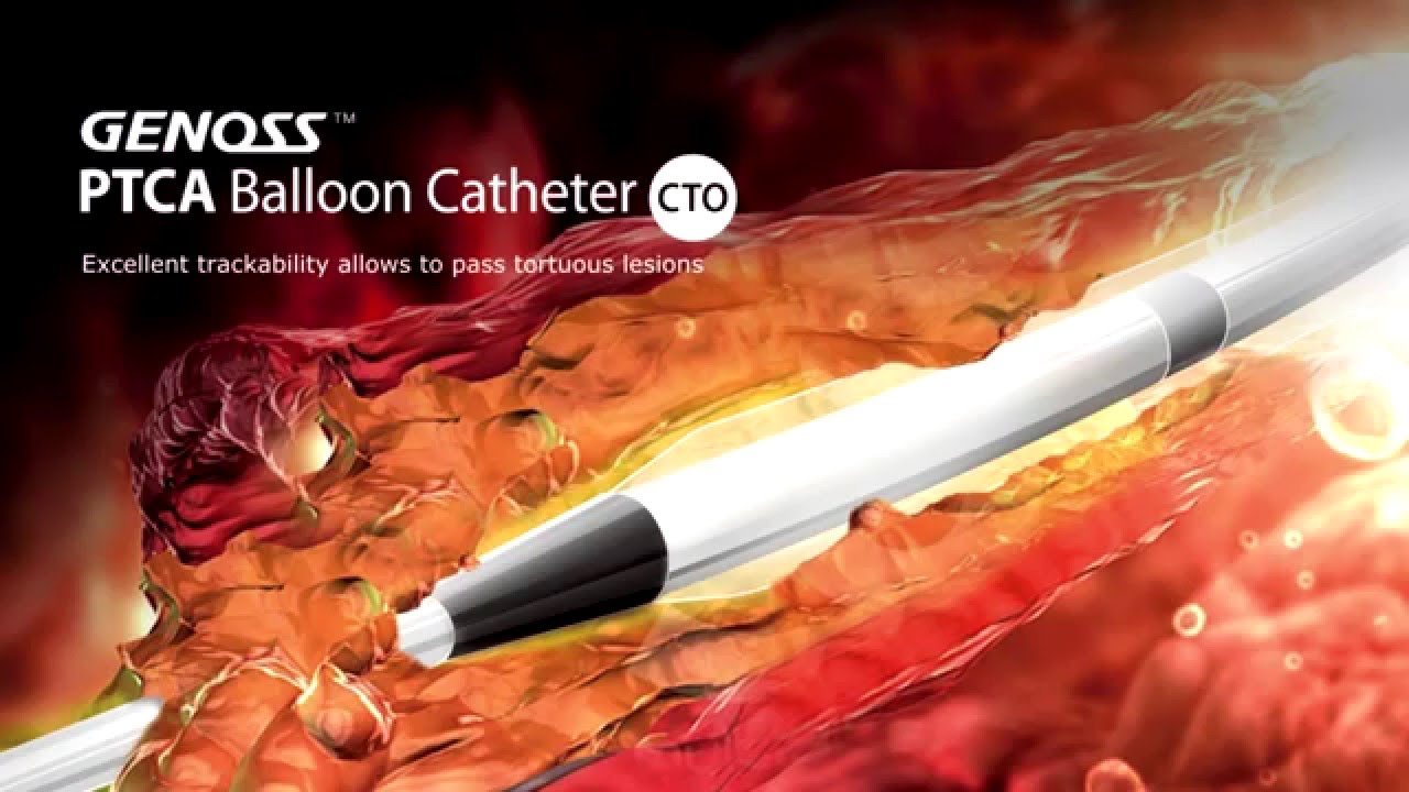 Genoss Cardiology System - YouTube