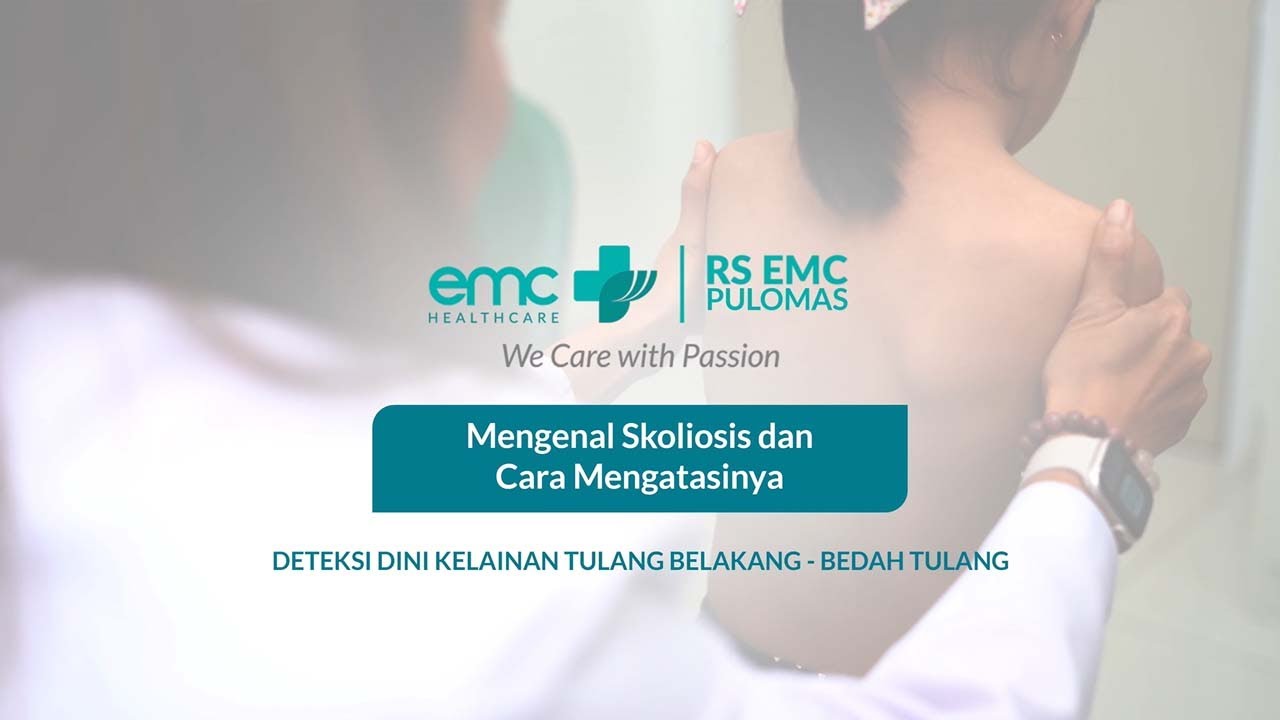 Mengenal Skoliosis dan Cara Mengatasinya - EMC Pulomas - YouTube