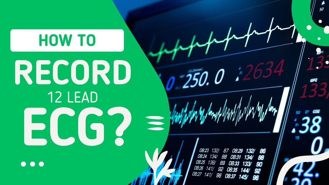 Recording a 12 lead ECG Or EKG - YouTube