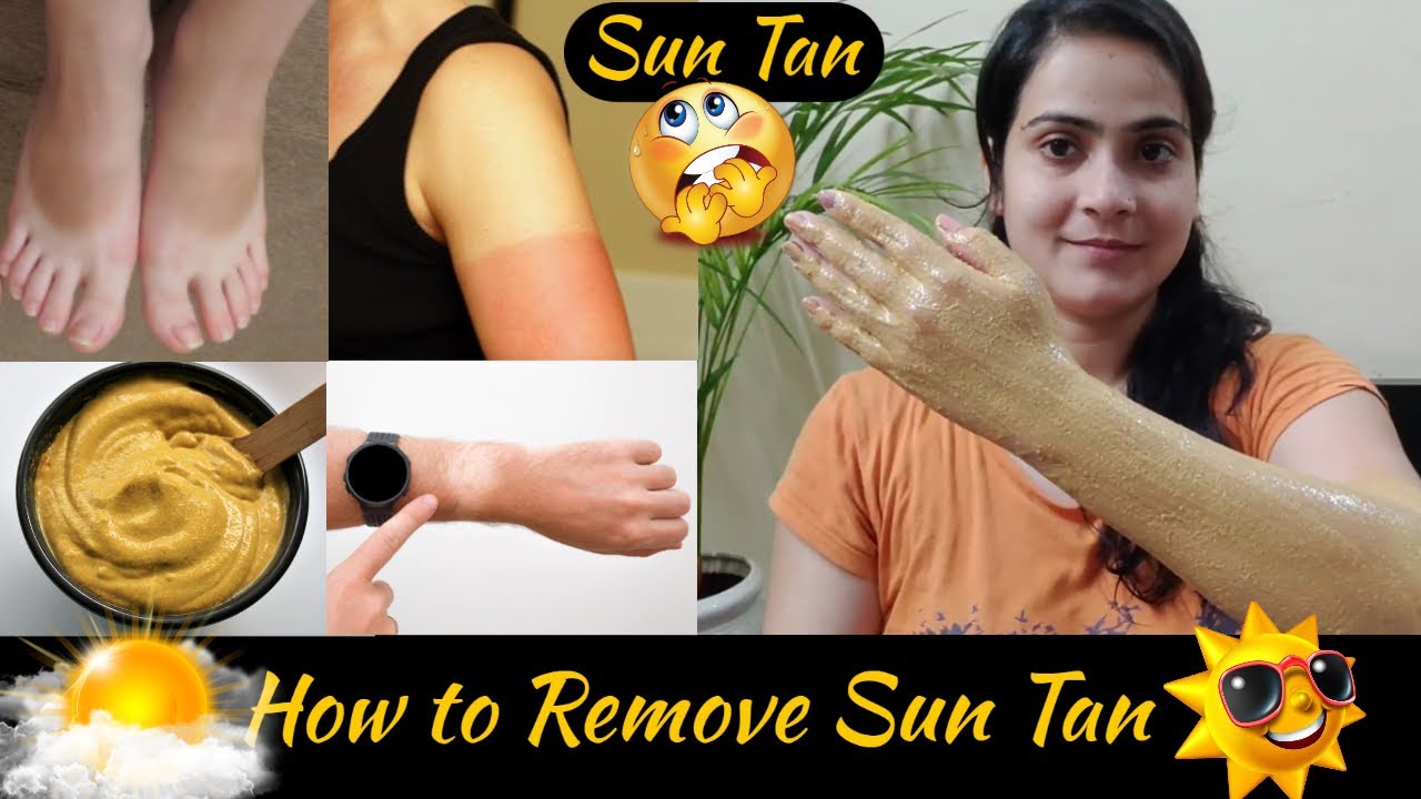 Remove Sun Tan From Body At Home | सन टैन रिमूवल होम रेमेडी | Remove ...