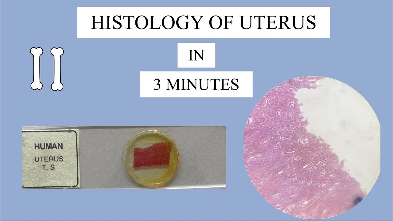 Histology of Uterus | Female reproductive system | Anatomy | MBBS ...