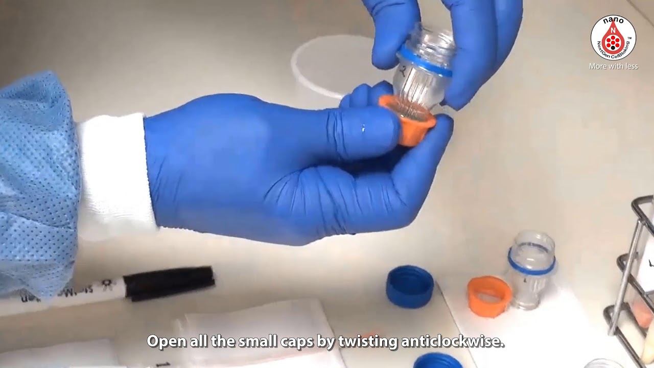 02 Simultaneous processing of multiple specimens to make cell blocks ...