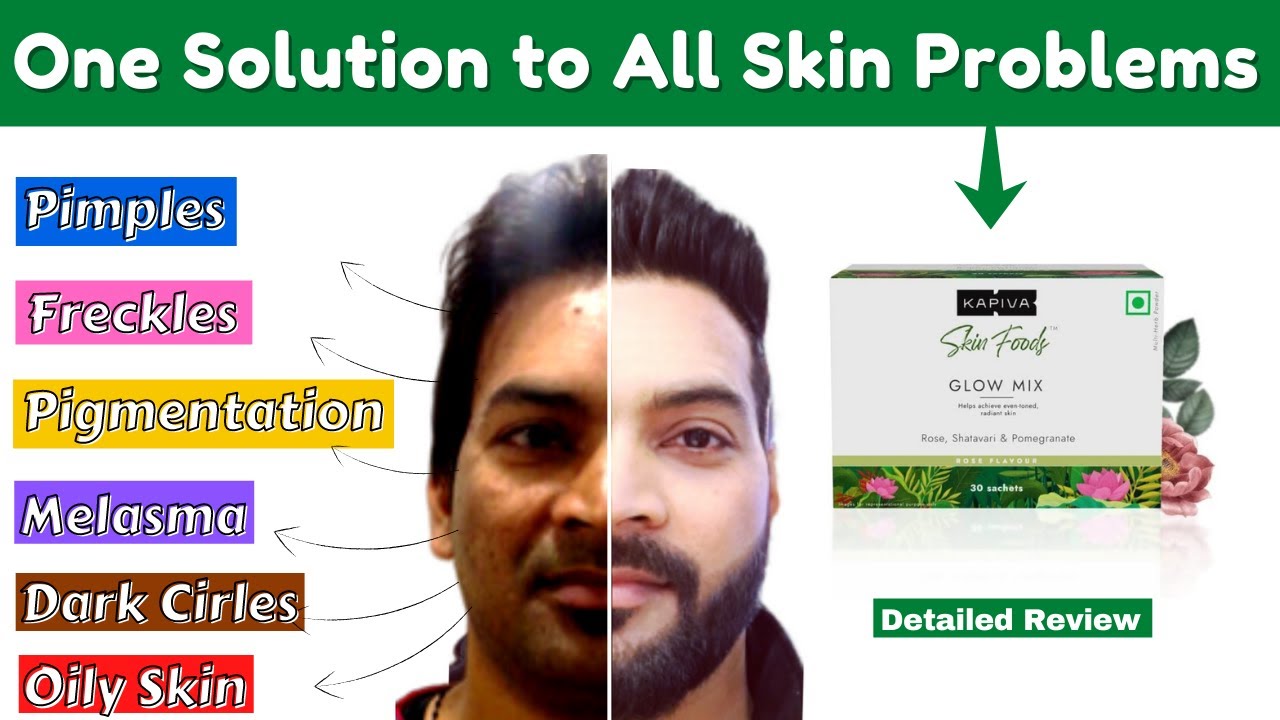 One Solution to All the Skin Problems - Melasma, Dark Circles, Freckles ...