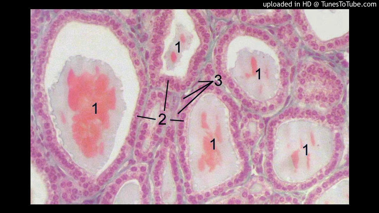 Microanatomy of the thyroid gland - YouTube
