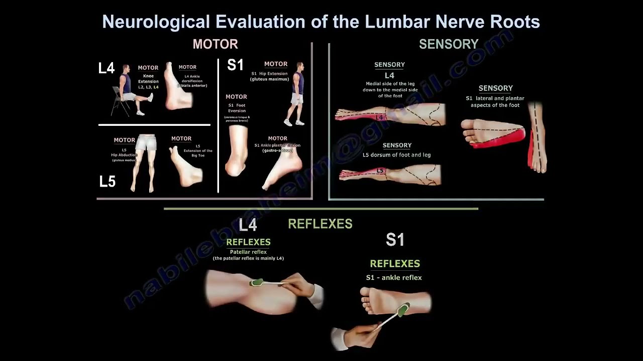 Ankle Dorsiflexion Nerve Root